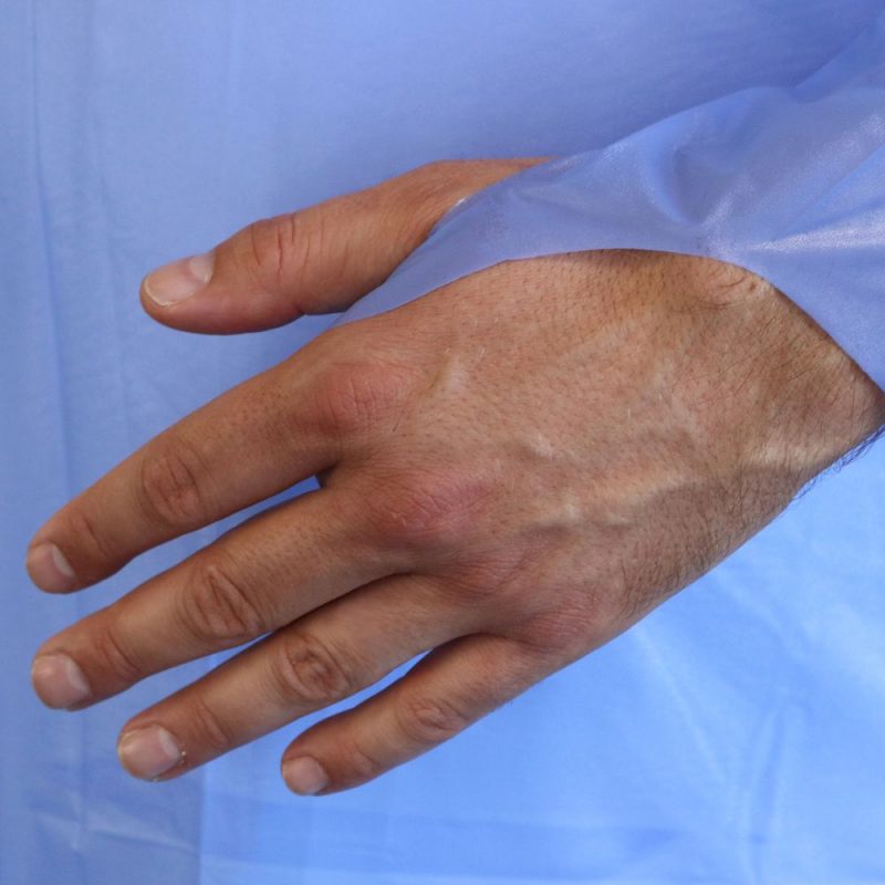 PVC Gown With Thumb Loop - General Hygiene Supplies